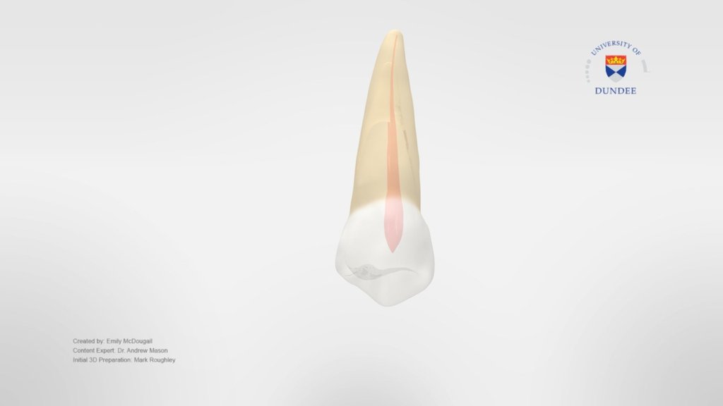 Maxillary First Premolar - Endodontic - 3D model by University of ...