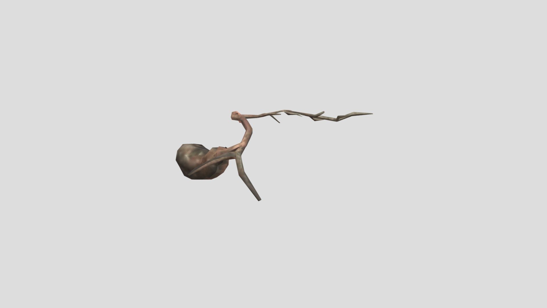 Gall Bladder 10393 Download Free 3d Model By Saravananm4594 [5b24a8d