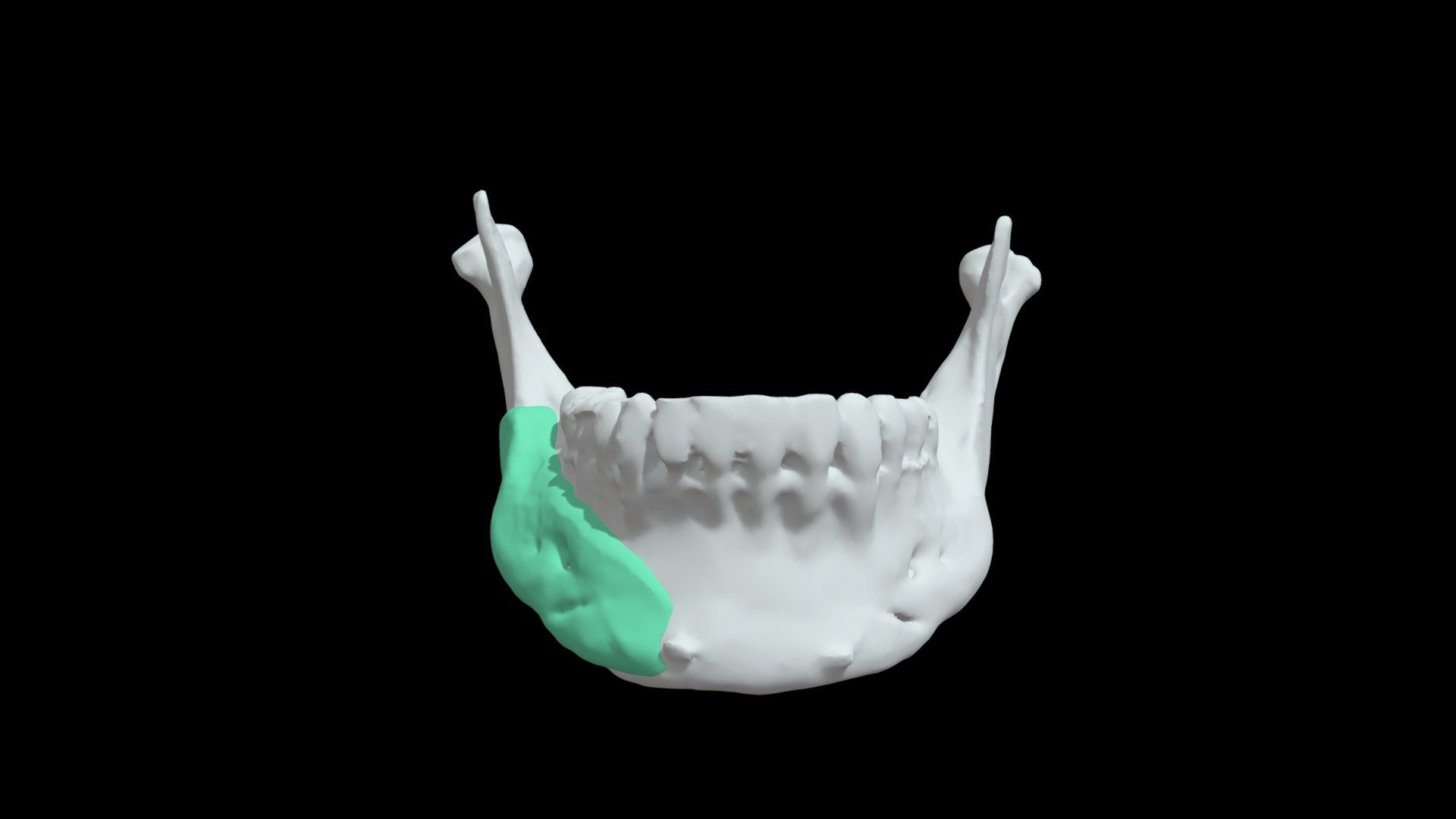 MMH DR.Liu -0913 - 3D model by vivian.detekt [5baefb9] - Sketchfab