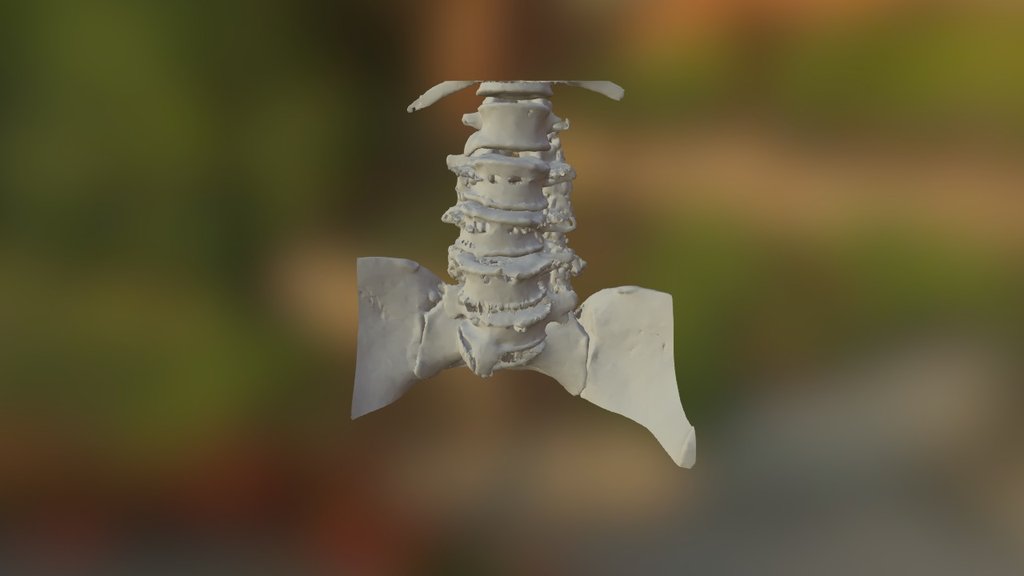 Lumbar Spine - sku 112 - 3D model by orto3d [5bf492e] - Sketchfab
