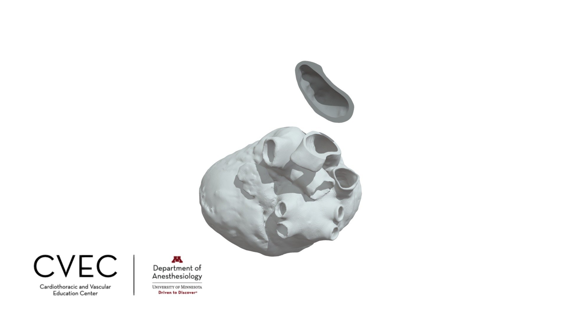 UE Aortic Arch LAX - 3D model by CVEC [5c0078f] - Sketchfab