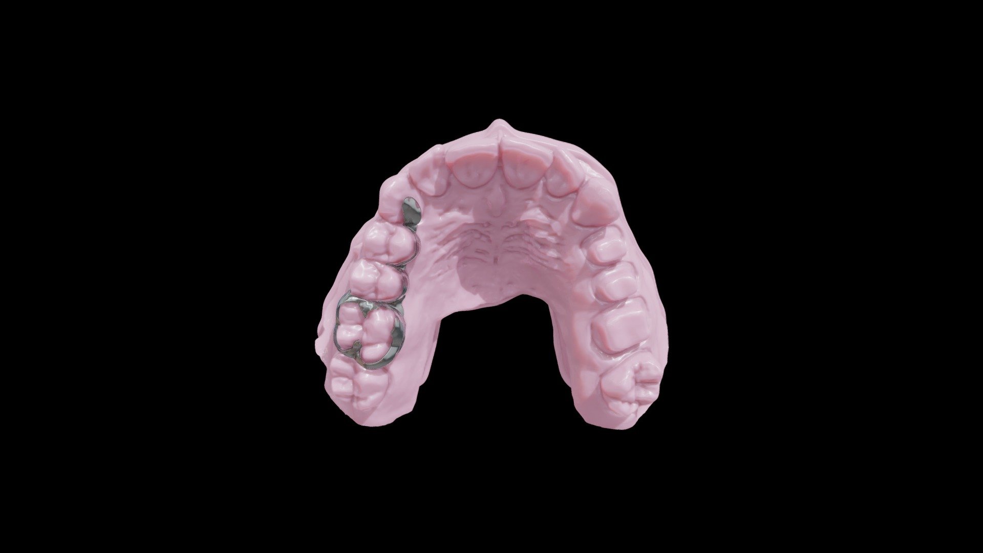 Modelo banda - 3D model by Juan I. Cruz R. Smart Anatomy ® (@juigcrra ...