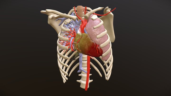Angiography 3D models - Sketchfab