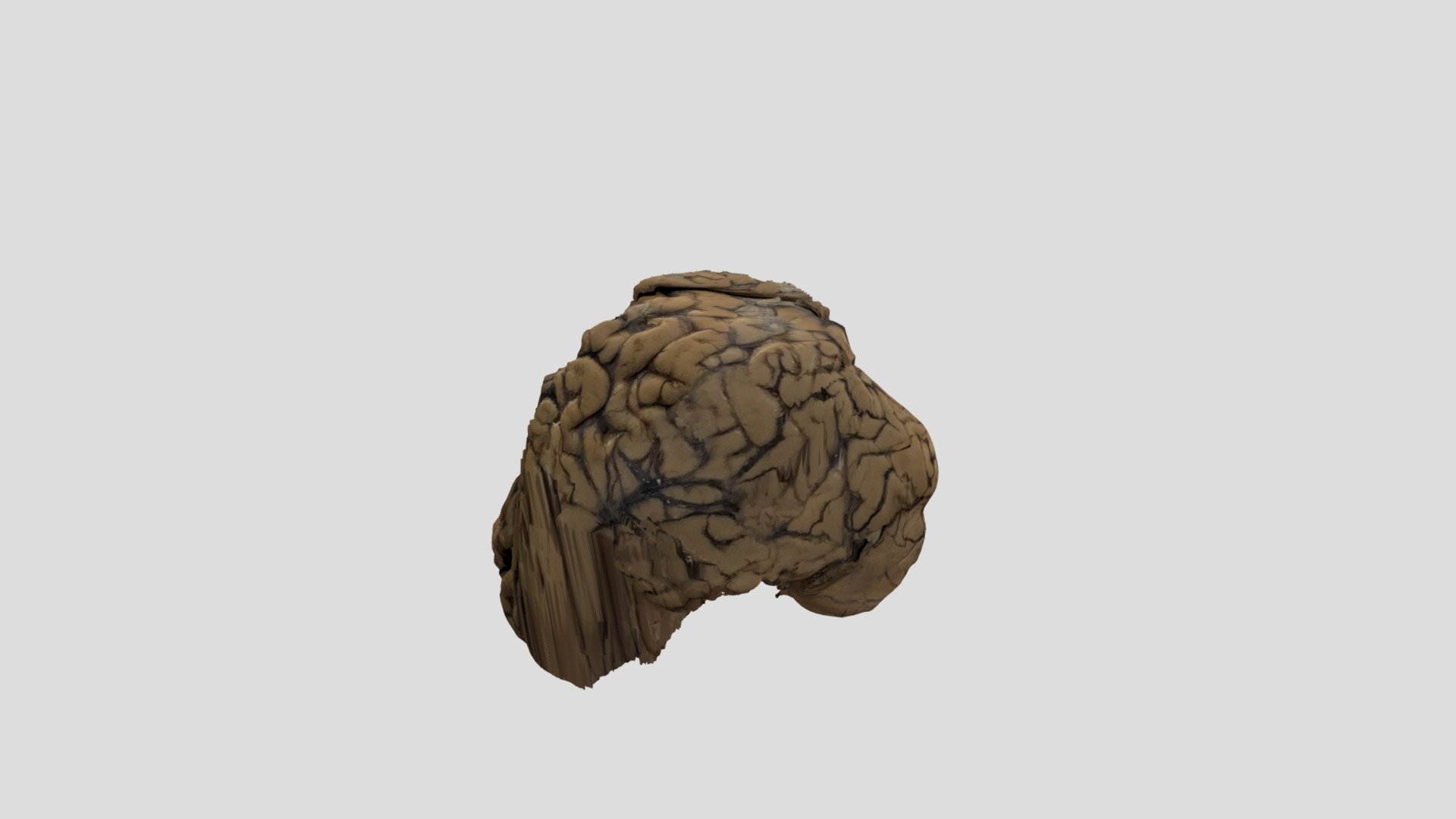 Internal Capsul, Meyer's Loop, Optic Radiatio - 3D model by ...