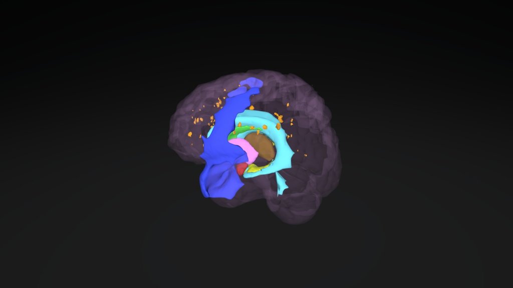 Brain Model 1 - 3D model by Tracy A (@tabildskov) [5ced684] - Sketchfab