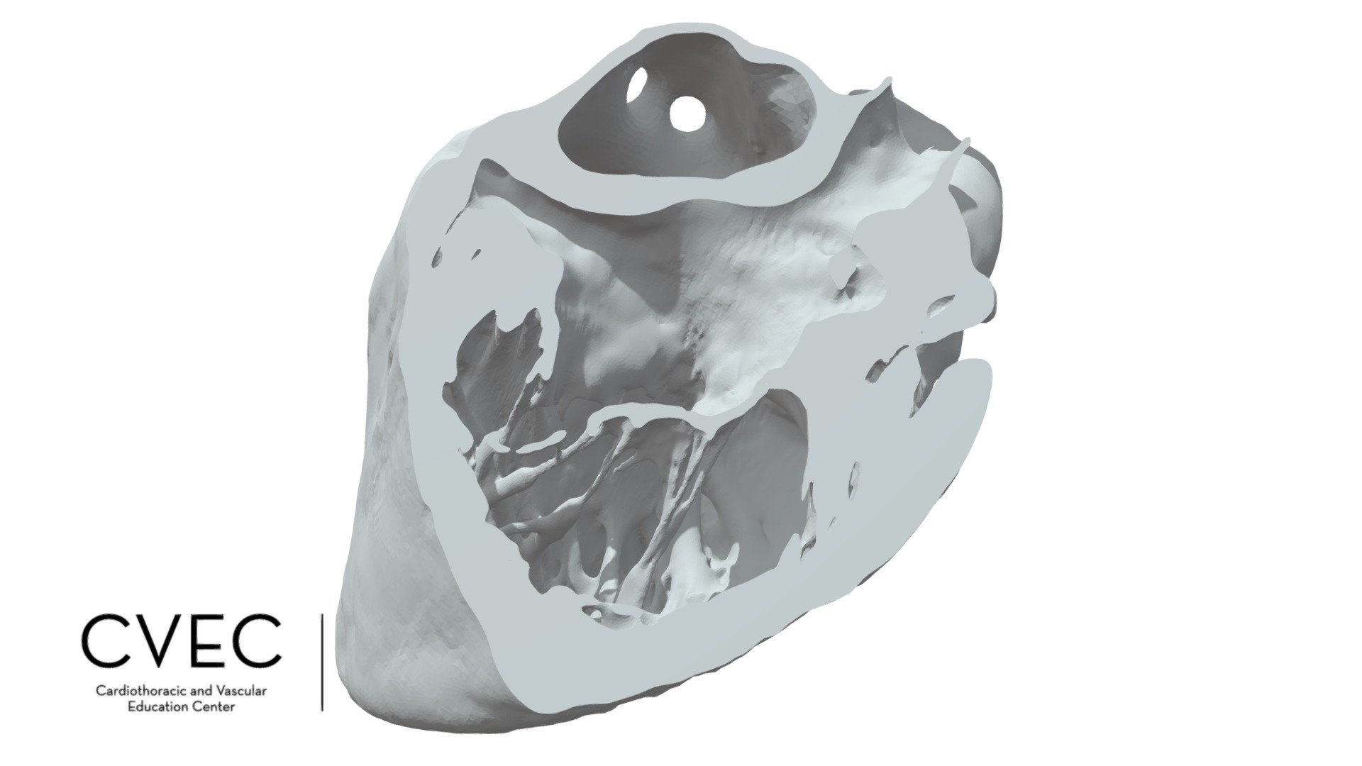 TEE Modified bicaval - 3D model by CVEC [5d216f1] - Sketchfab