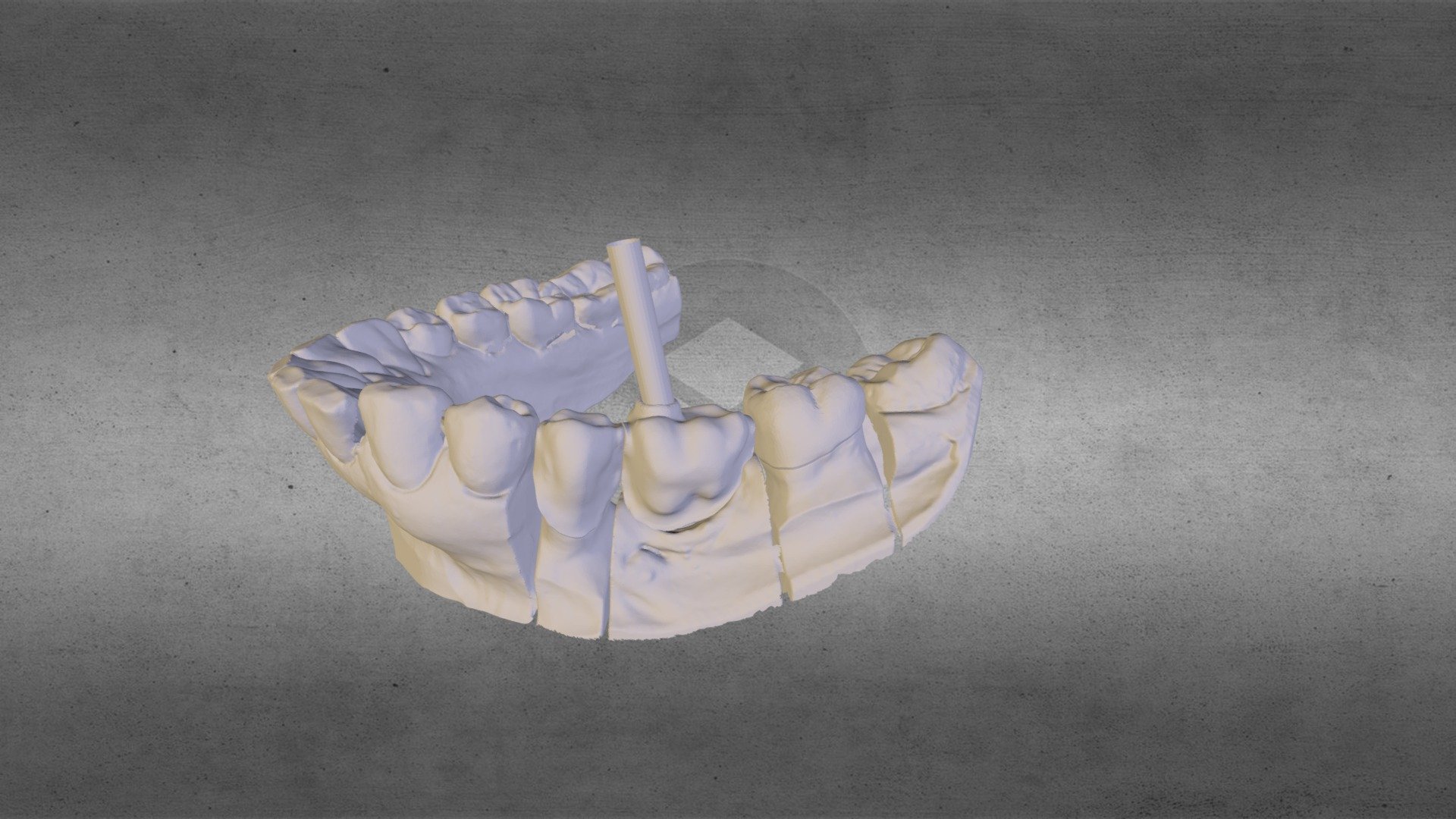 Zirconia frameworks - 3D model by CaptainMESH [5d934de] - Sketchfab