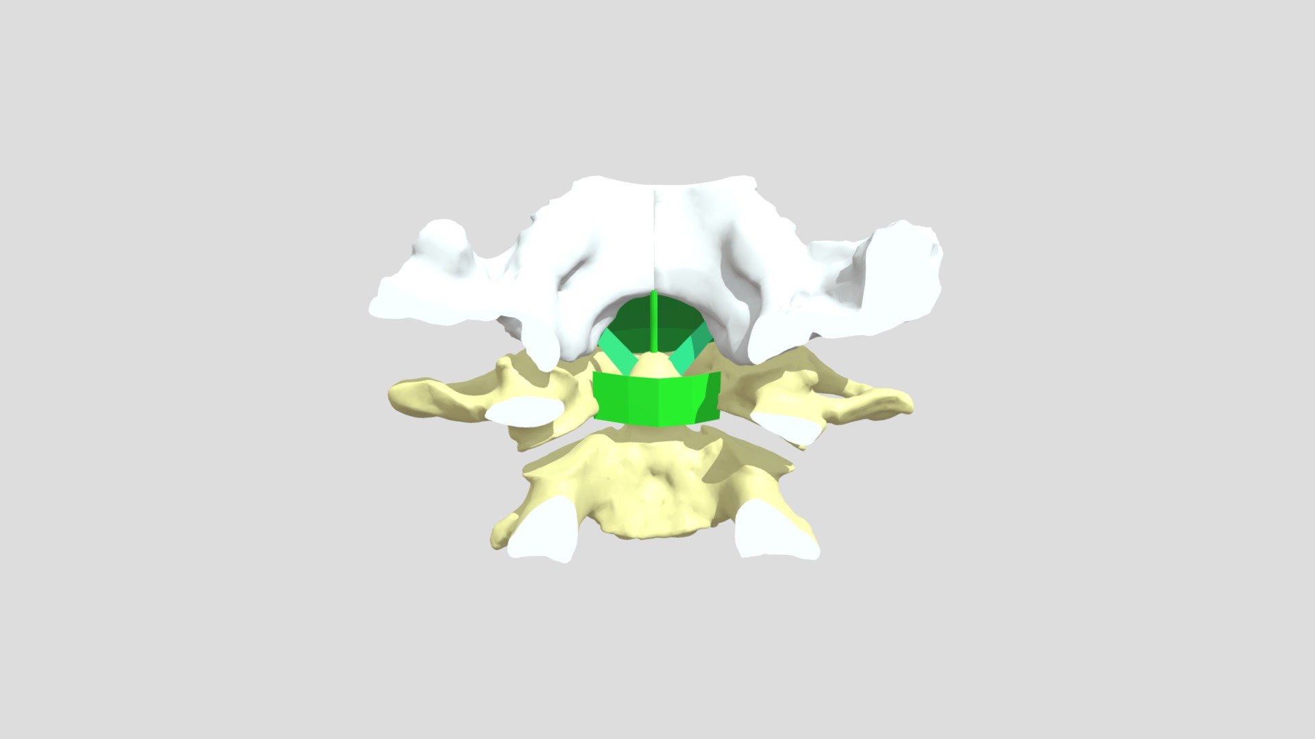 Atlantoaxial joint C1-C2 - 3D model by VivekAnatomy [5ef24fa] - Sketchfab