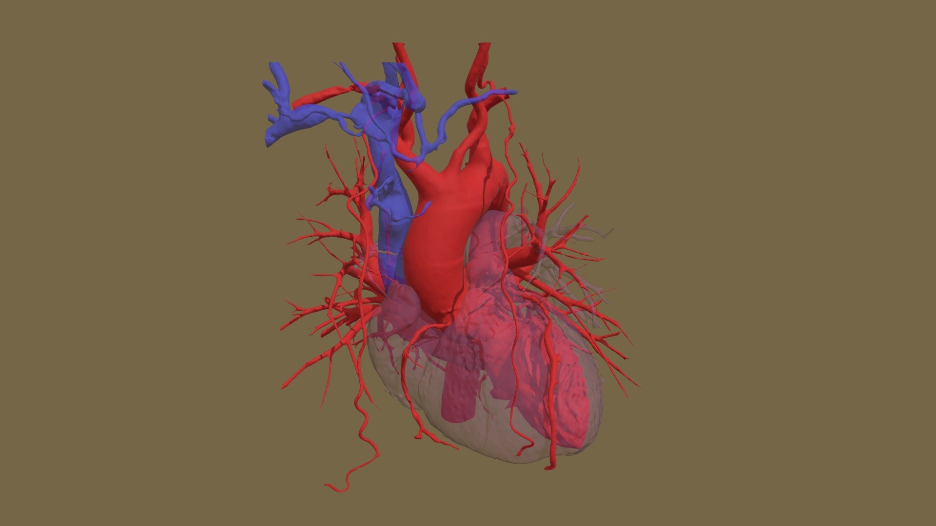 CUORE SF_RV_ARTERIOSO - 3D model by 3Dsurgery [5f3b7a9] - Sketchfab