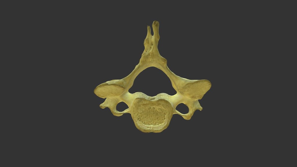 Cervical Vertebra with Texture - 3D model by Wellesley College ...