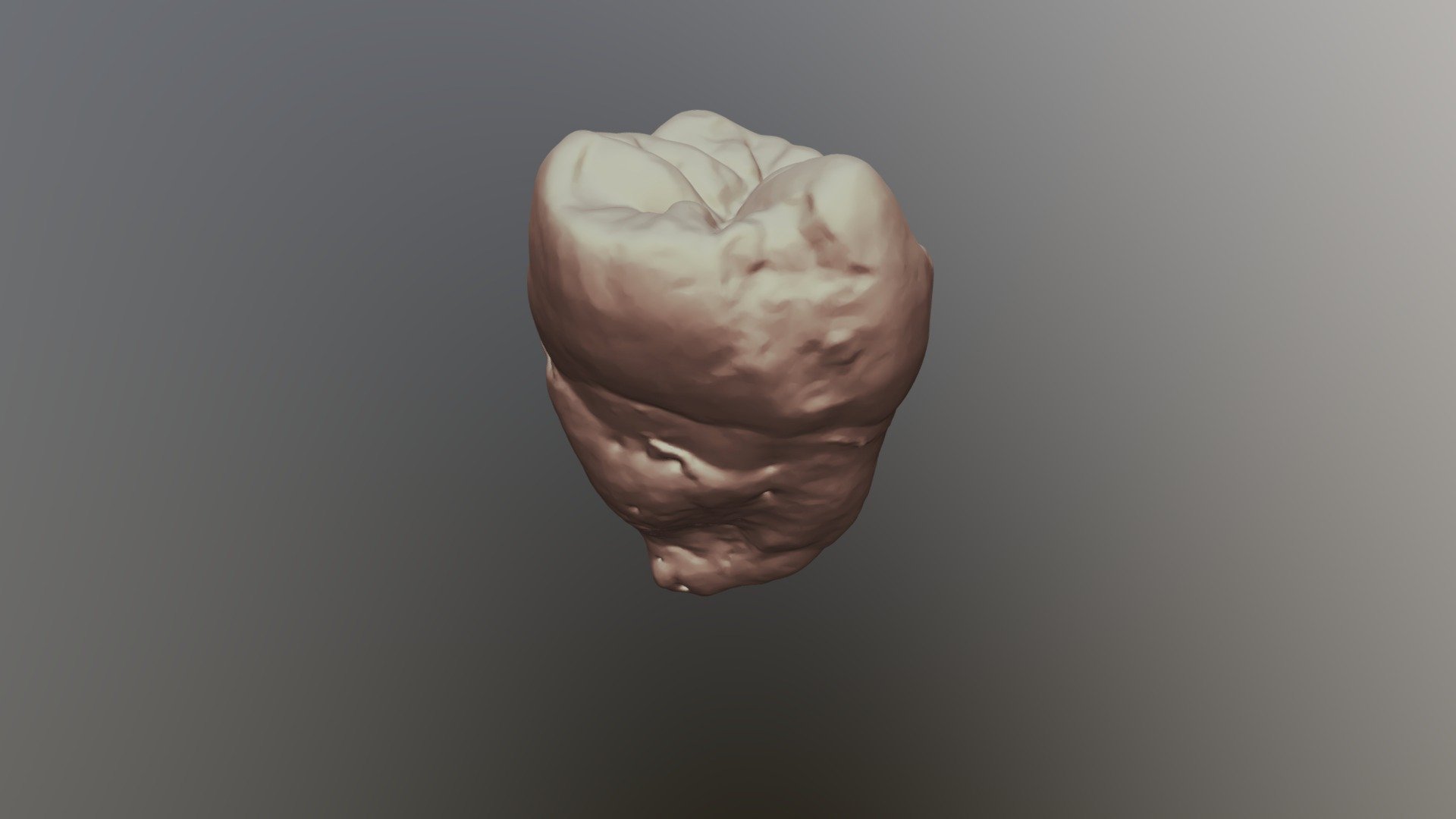 Wisdom tooth - Download Free 3D model by rojohaku [5fd2654] - Sketchfab