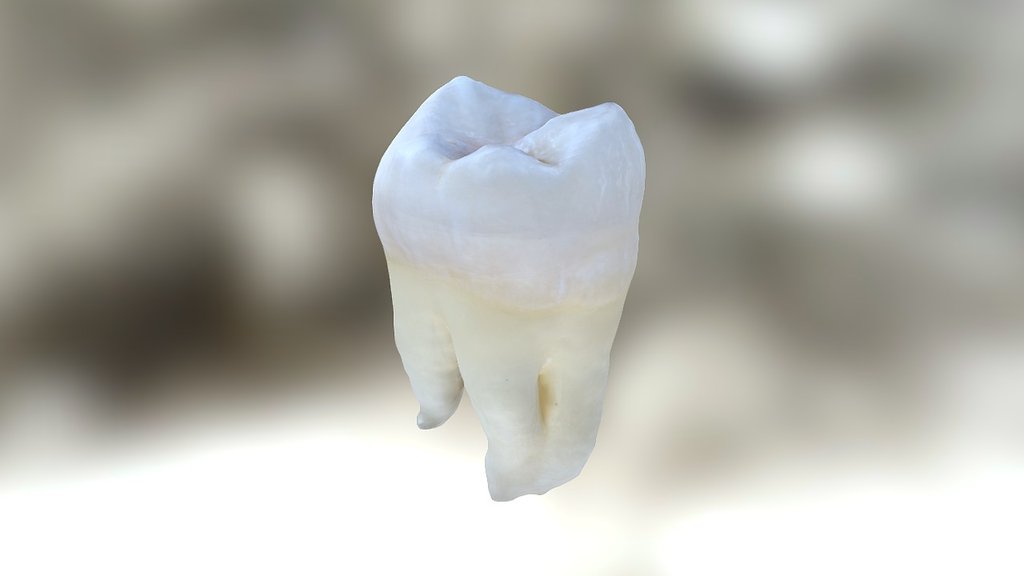 Third molar - 3D model by Virtuous Reality (@ealpop) [605a904] - Sketchfab