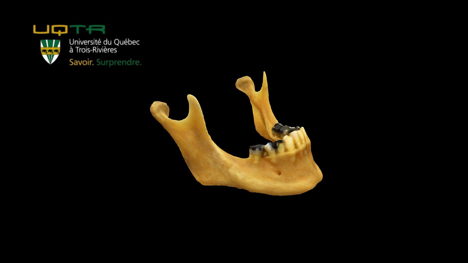 Mandibule / Mandible - 3D model by Anatomie UQTR - Anatomy UQTR ...