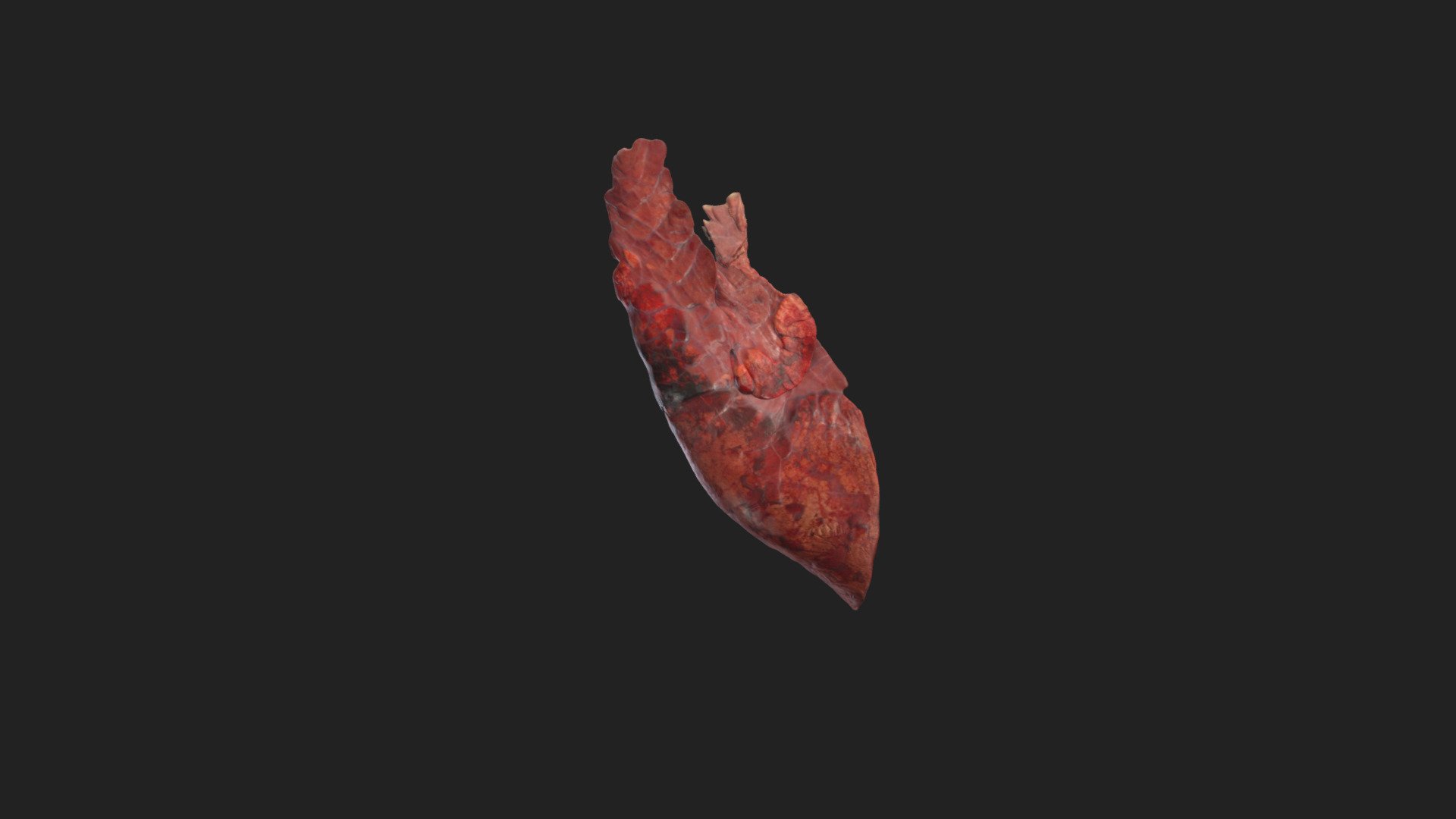 Pneumonia - 3D model by vetpathMunich [6086d28] - Sketchfab