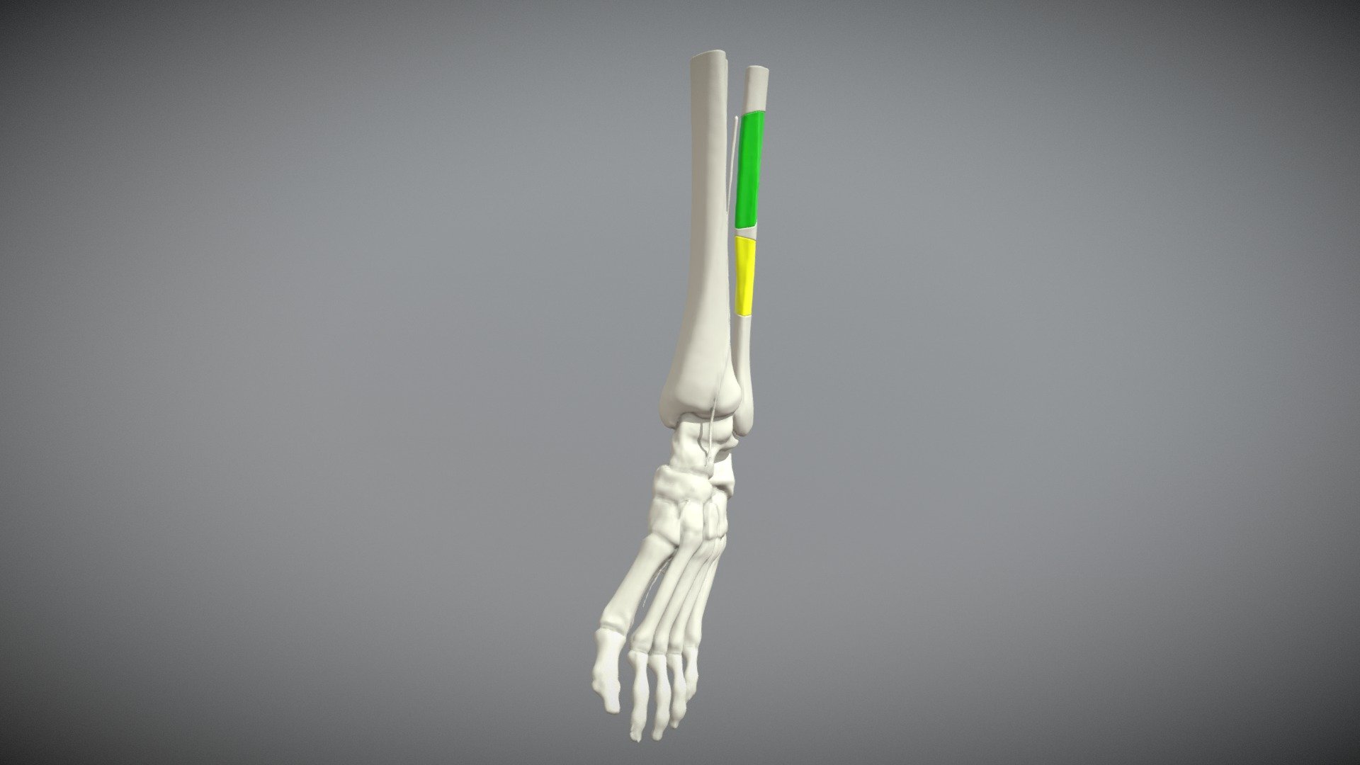 Fibular Segments: Mandibular Reconstruction - 3D model by MMI2018 ...