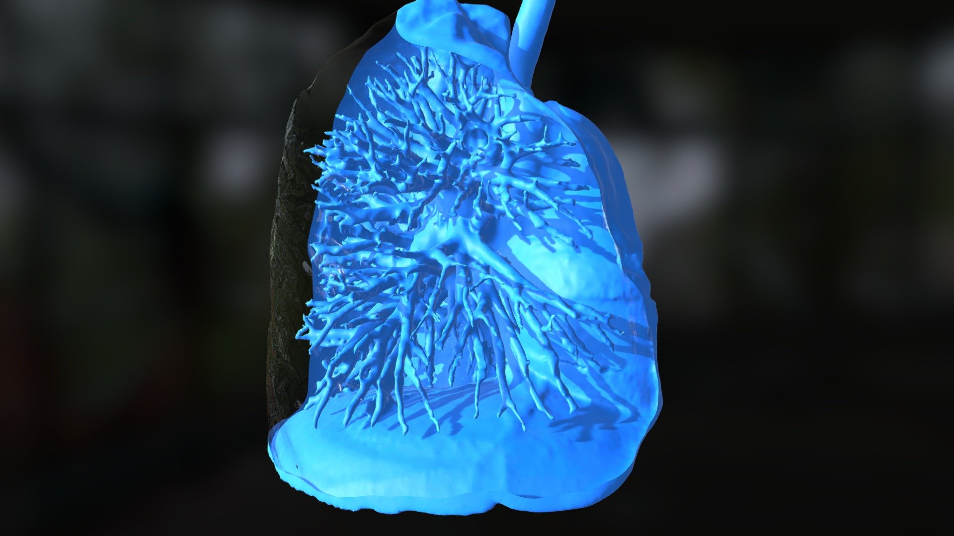 Pulmon Normal - 3D model by quequen [60b2403] - Sketchfab
