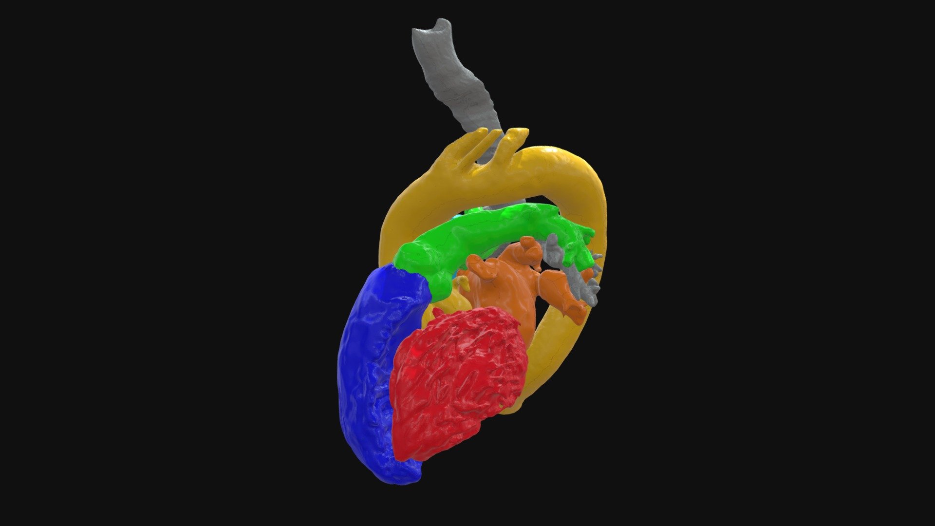 2018023 Ascending Aortic Aneurysm - 3D model by APIL (@apil_tgh ...