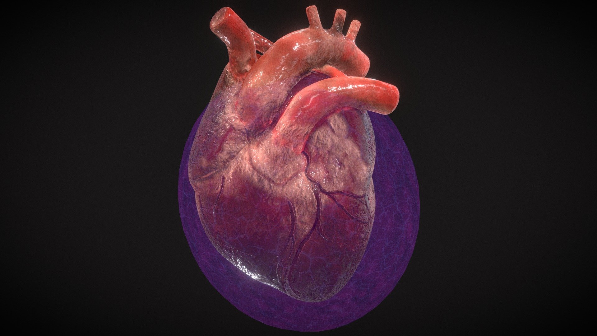 ModelHuman Heart Pericarditis - Buy Royalty Free 3D model by Guxart3D ...