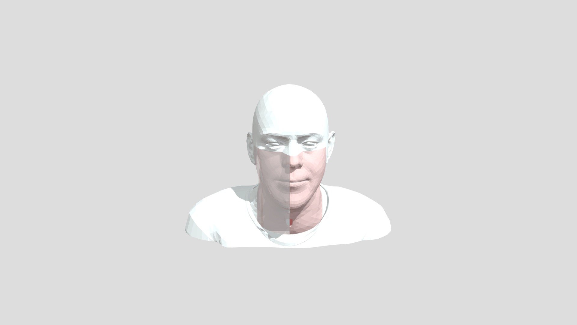laryngectomy_Stoma_head - Download Free 3D model by Keith_Pamment ...