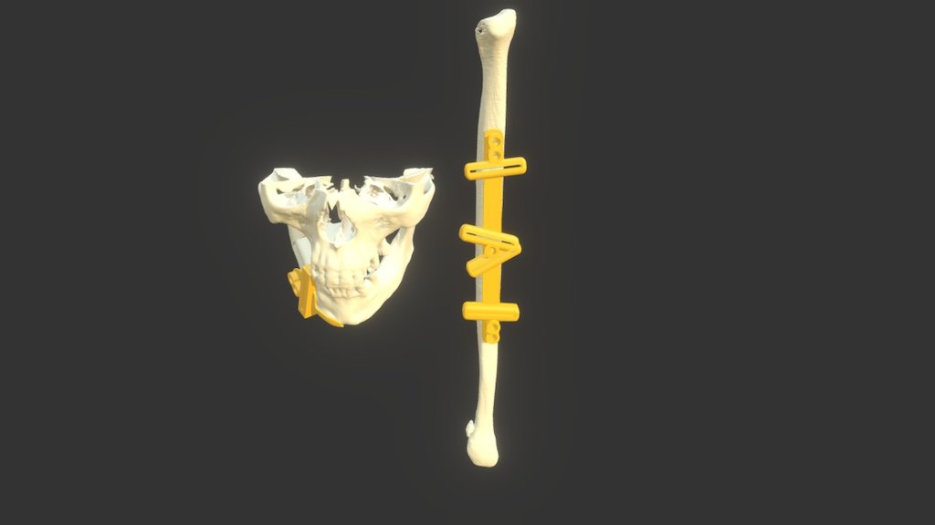 (Dr Criado) Dig_Hilda - 3D model by incremental [634538a] - Sketchfab