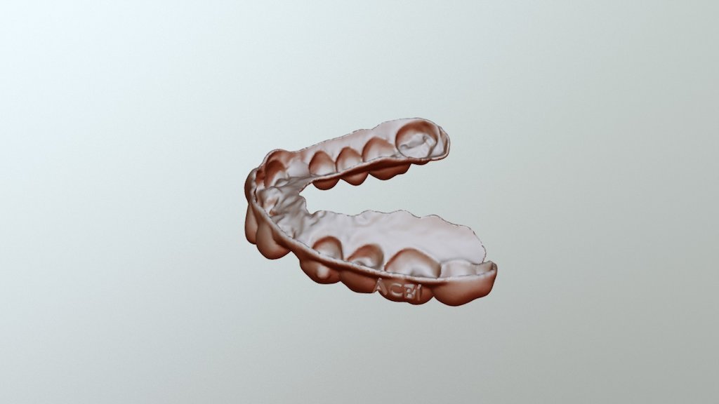 7 - Superior - 01 - Modelo - Clear Aligner - 3D model by ...