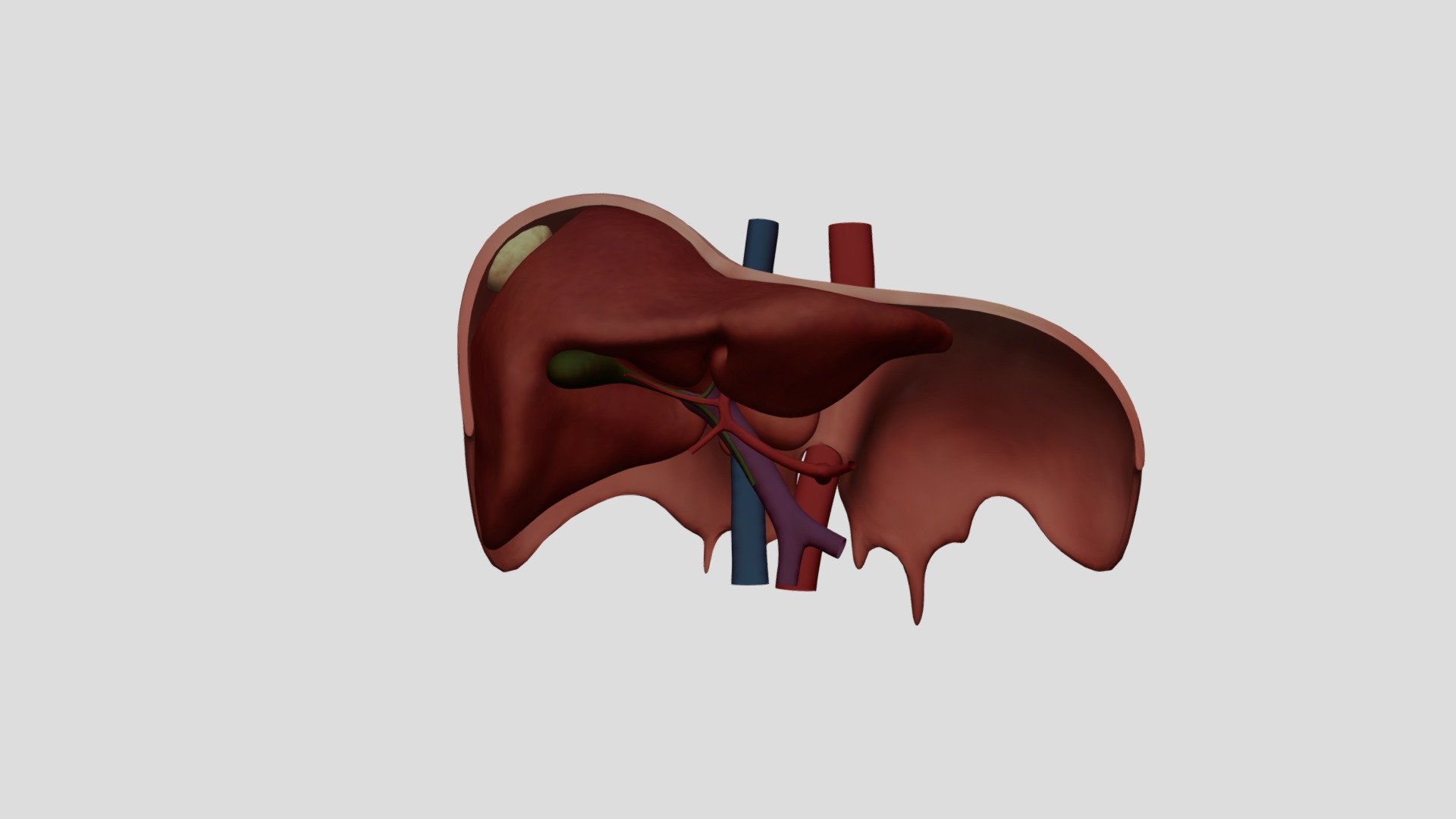 Segment 8 Hepatic Dome Lesion - 3D model by TVASurg [641d389] - Sketchfab