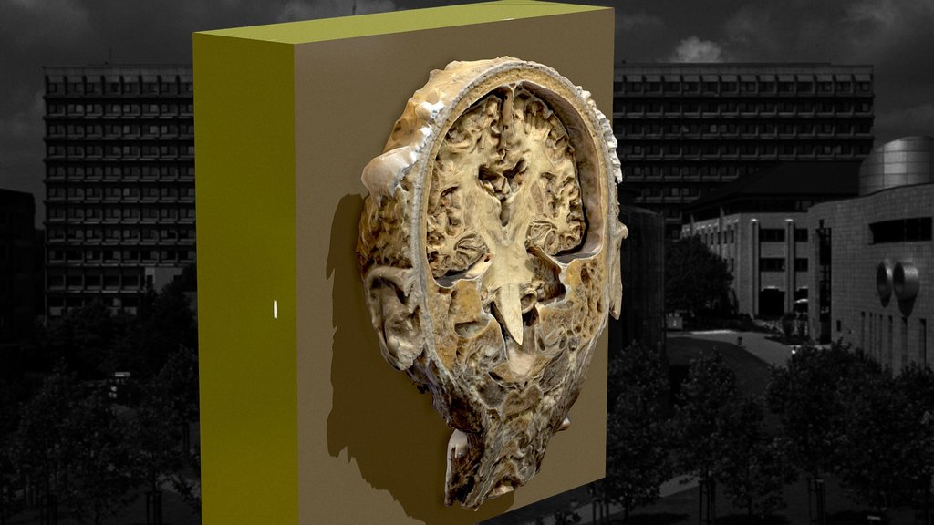 Dissection - A 3D model collection by Prof. Serge VAN SINT JAN - Univ ...