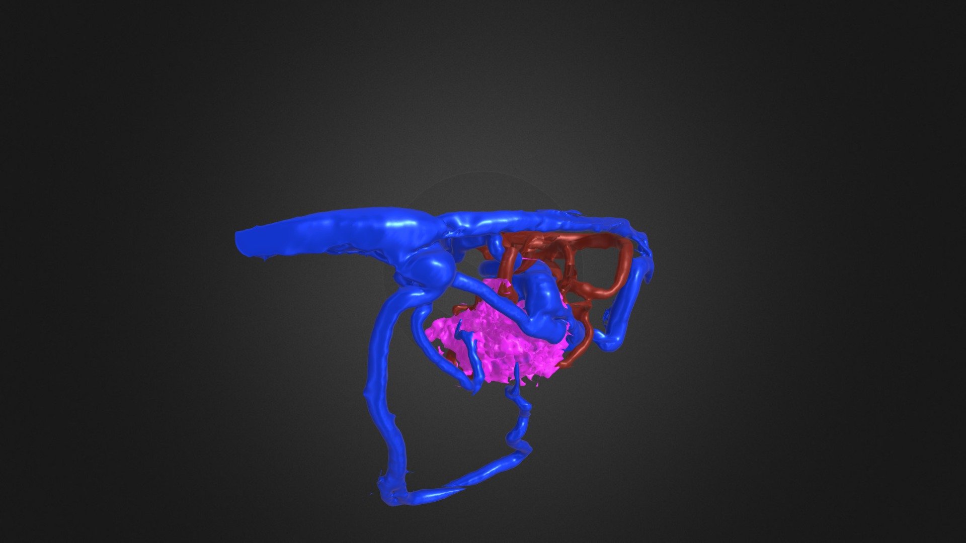 Frontal AVM - 3D model by jorgegonzalezcantero [64ee1d6] - Sketchfab