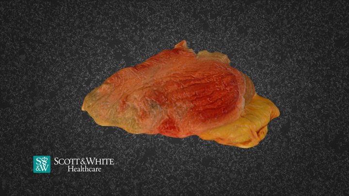 Appendix 3D models - Sketchfab