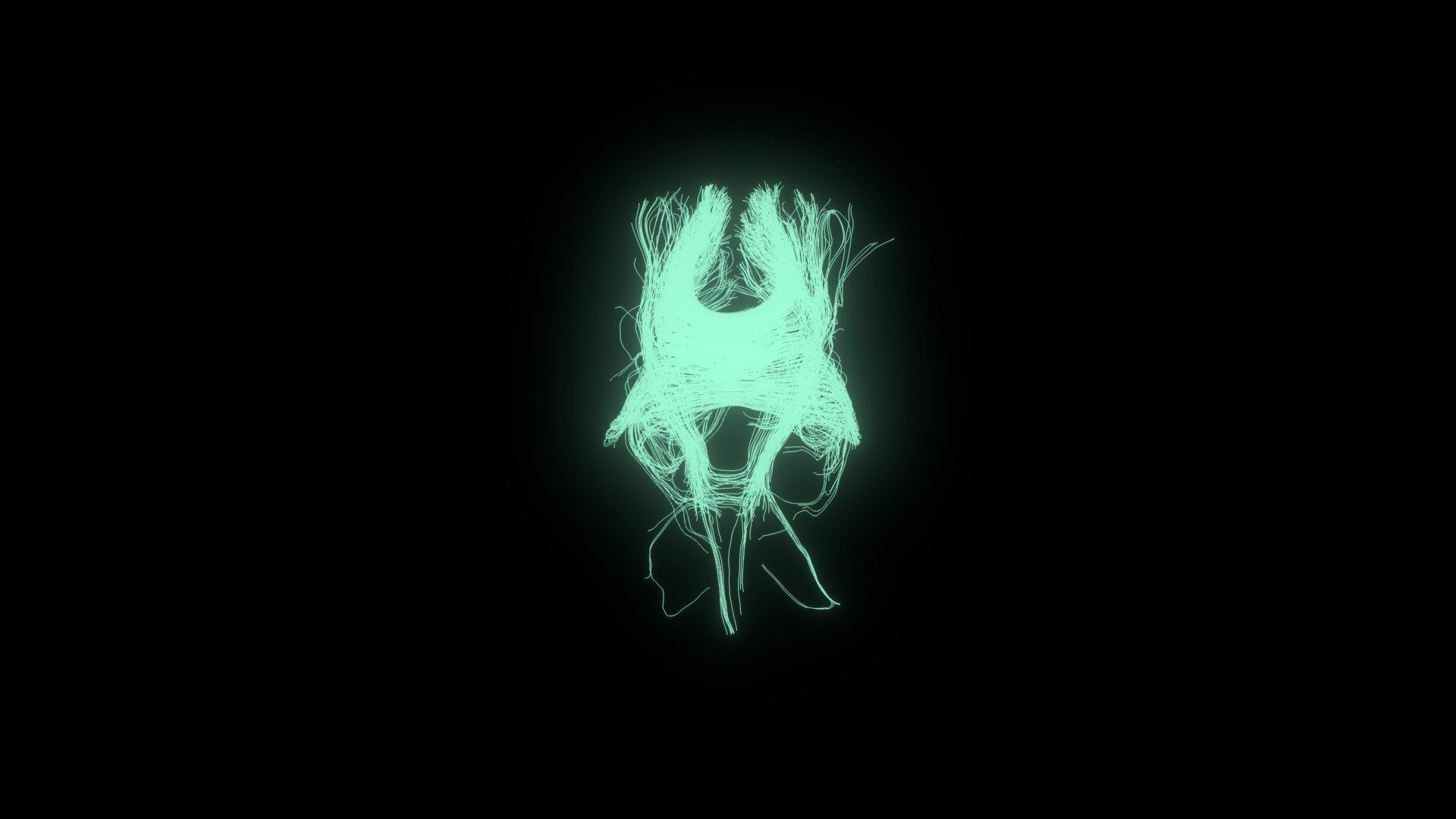 Projection Fibers from DWI/DTI Dataset - Download Free 3D model by ...