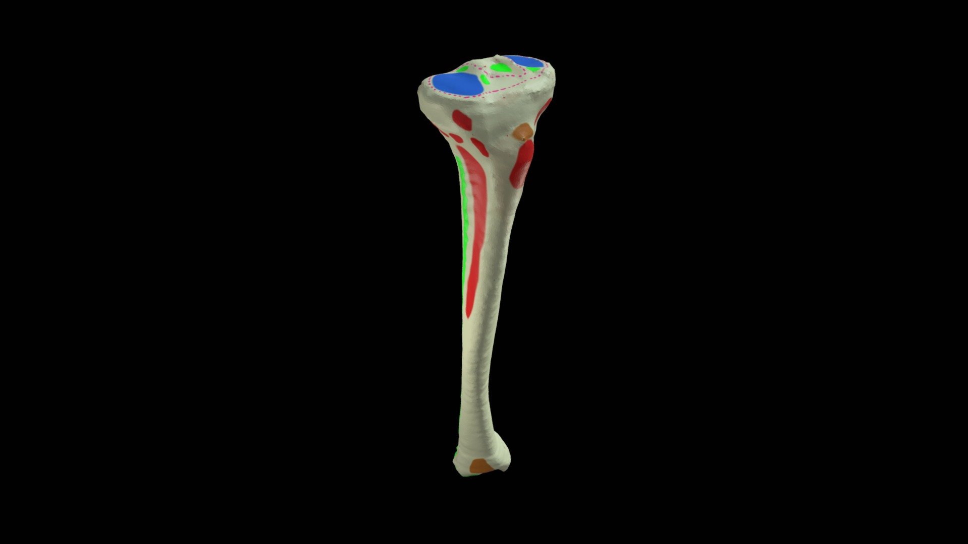 Tibia Coloré - 3D model by Prof. Serge VAN SINT JAN - Univ. Libre Bruxelles (@sergevansintjan ...