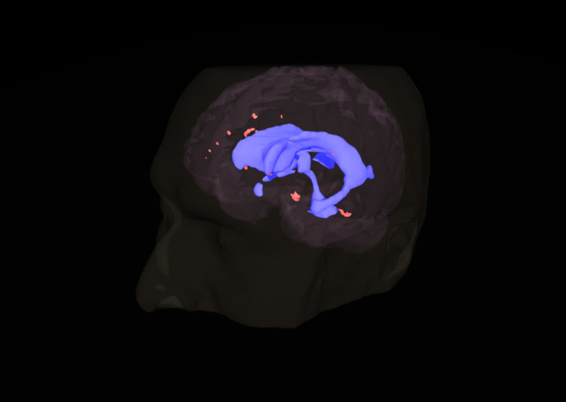 Brain Model 2 - 3D model by Tracy A (@tabildskov) [65a5f3e] - Sketchfab