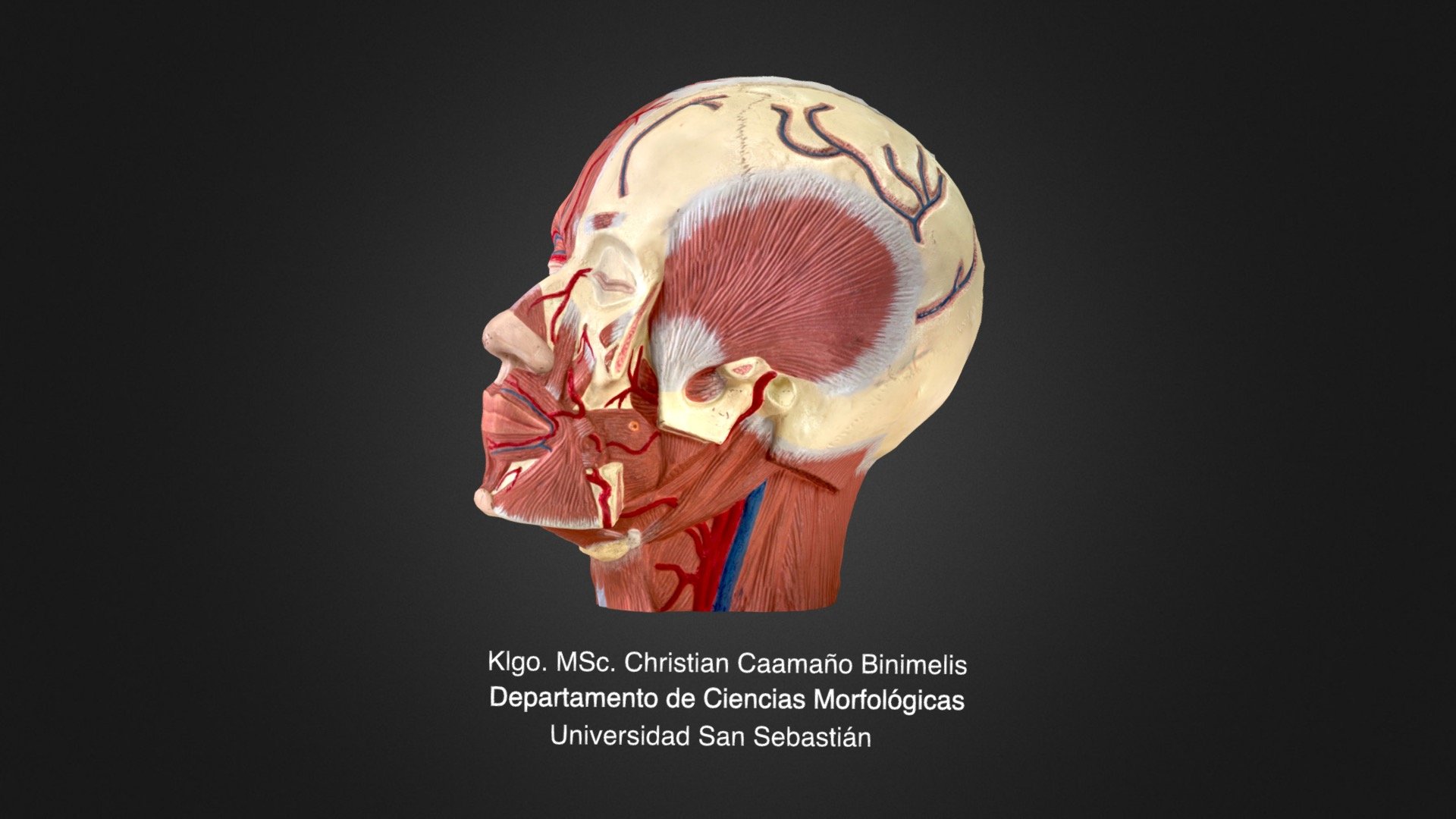 Cabeza Vascular - 3D model by Klgo. MSc. MBA. Christian Caamaño ...