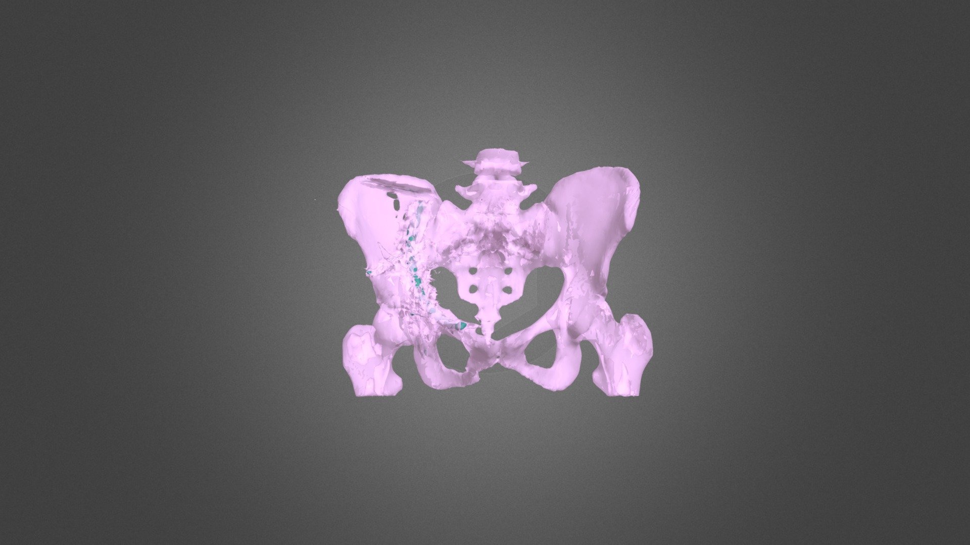Pelvix Segmentation - 3D model by Aubrianna (@AubriannaMHA) [65c81b2 ...