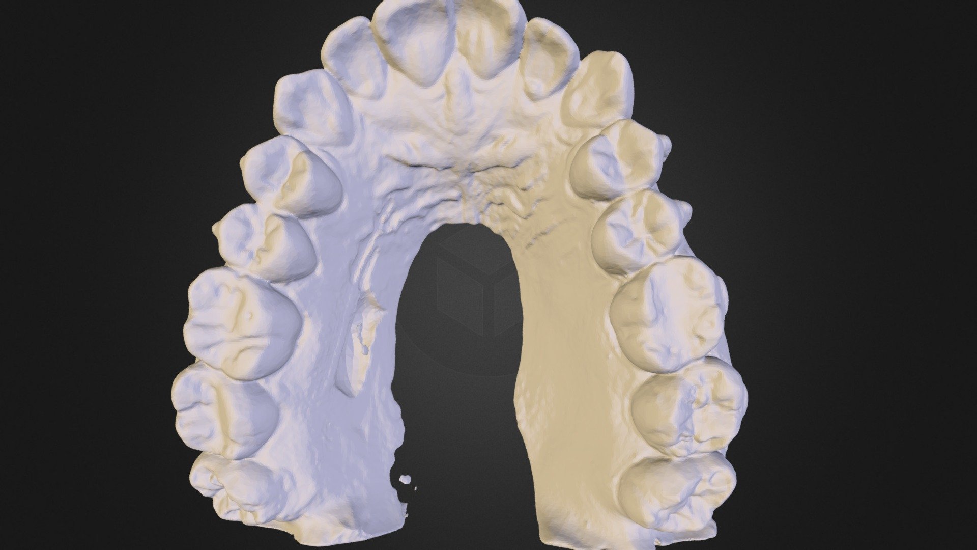 New Impression.stl - 3D model by AhmadHammad [65dPLOi] - Sketchfab
