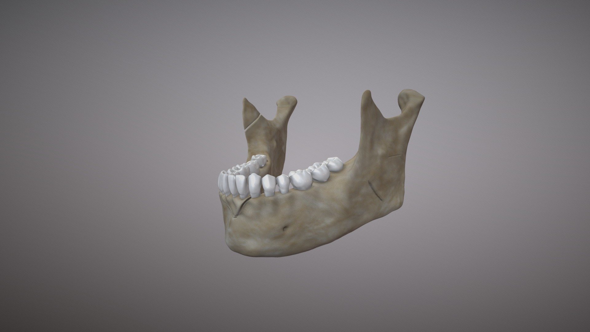 Sharp Force Trauma - 3D model by University of Dundee, CAHID (@anatomy ...
