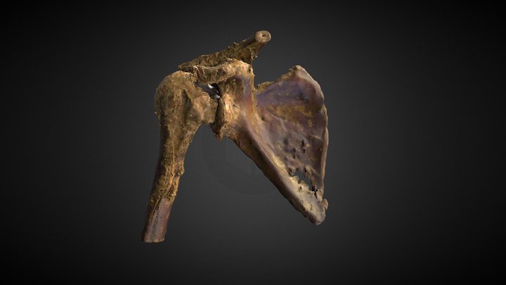 Acromion 3D models - Sketchfab
