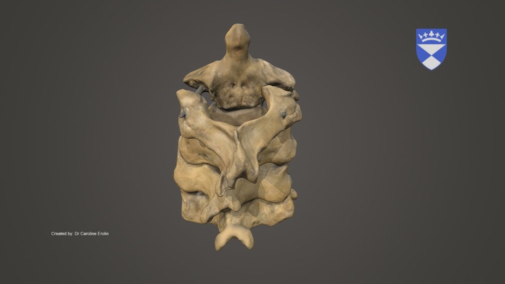 Vertebrae - 3D model by University of Dundee, CAHID (@anatomy_dundee ...