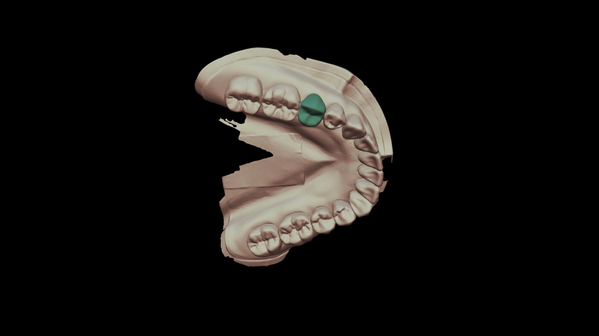 (First Year) #20 on Dentoform - 3D model by Se Won An (@sewonan ...