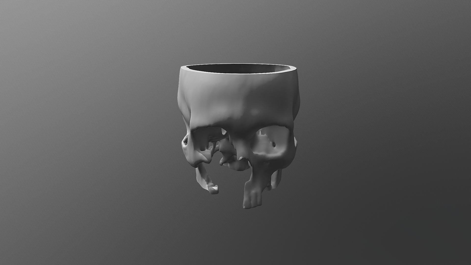 Massive skull defect - 3D model by valchanov [67fb8d9] - Sketchfab