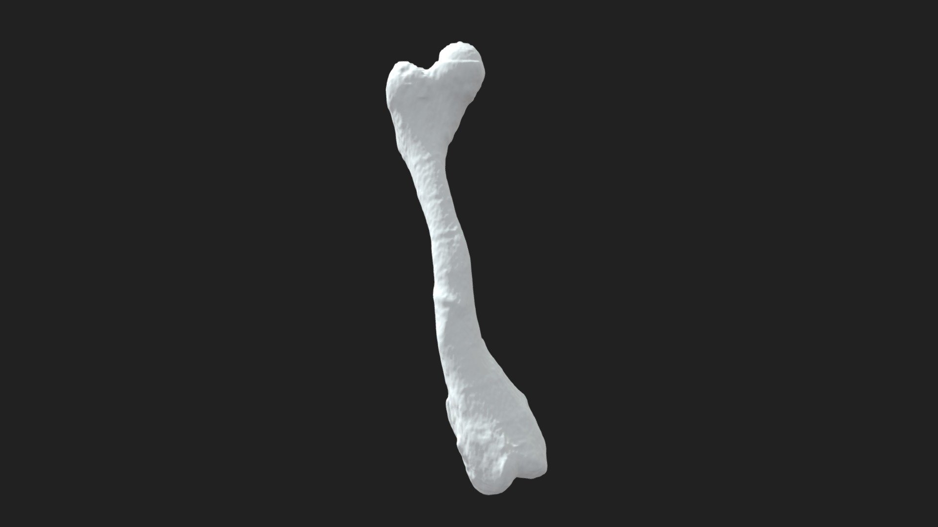 Right Femur - Surgical Planning - 3D model by APIL (@apil_tgh) [681ba4f ...