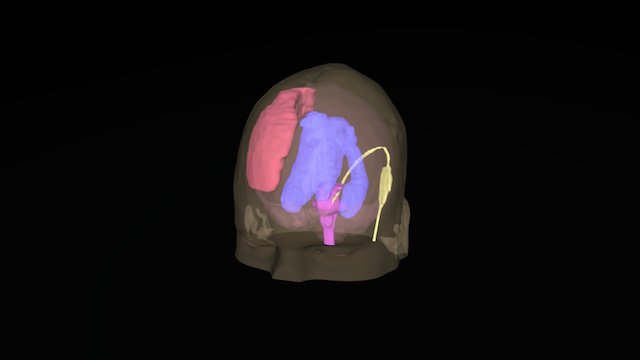 Shunt 3D models - Sketchfab