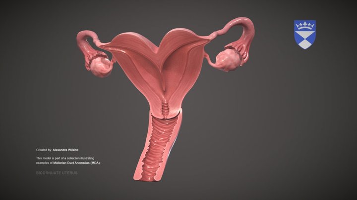 Uterus 3D models - Sketchfab