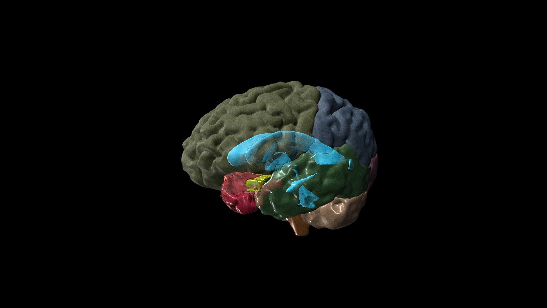 Missing Temporal Lobe - 3D model by Tracy A (@tabildskov) [68de4c8 ...