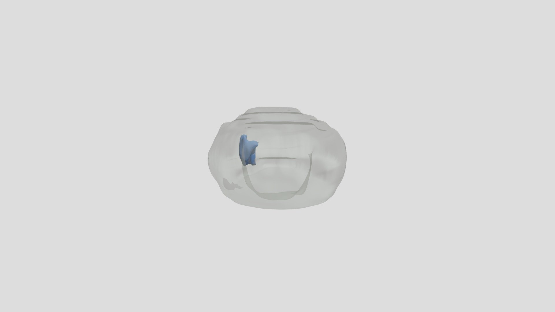 Liposome Infusion - 3D model by Andrew Pickering (@andrewpickering87897 ...