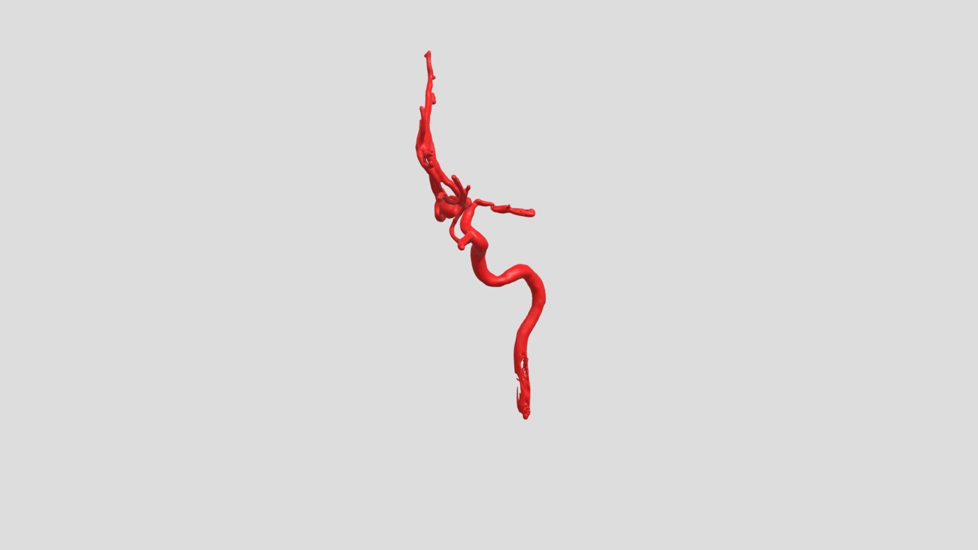 acom_aneurysm - 3D model by zwilseck [69a92e3] - Sketchfab