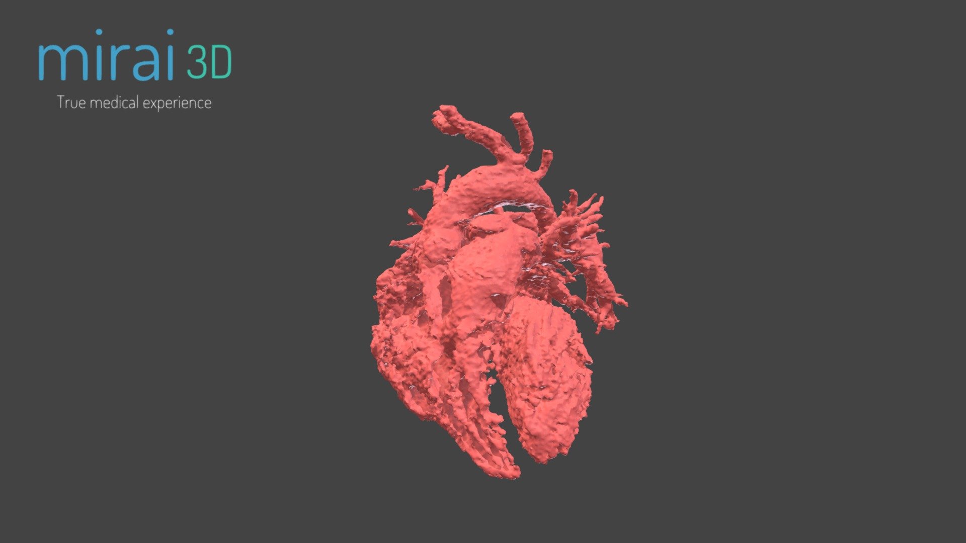 Medical Model WP2 - 3D model by MIRAI3D [69b10e8] - Sketchfab