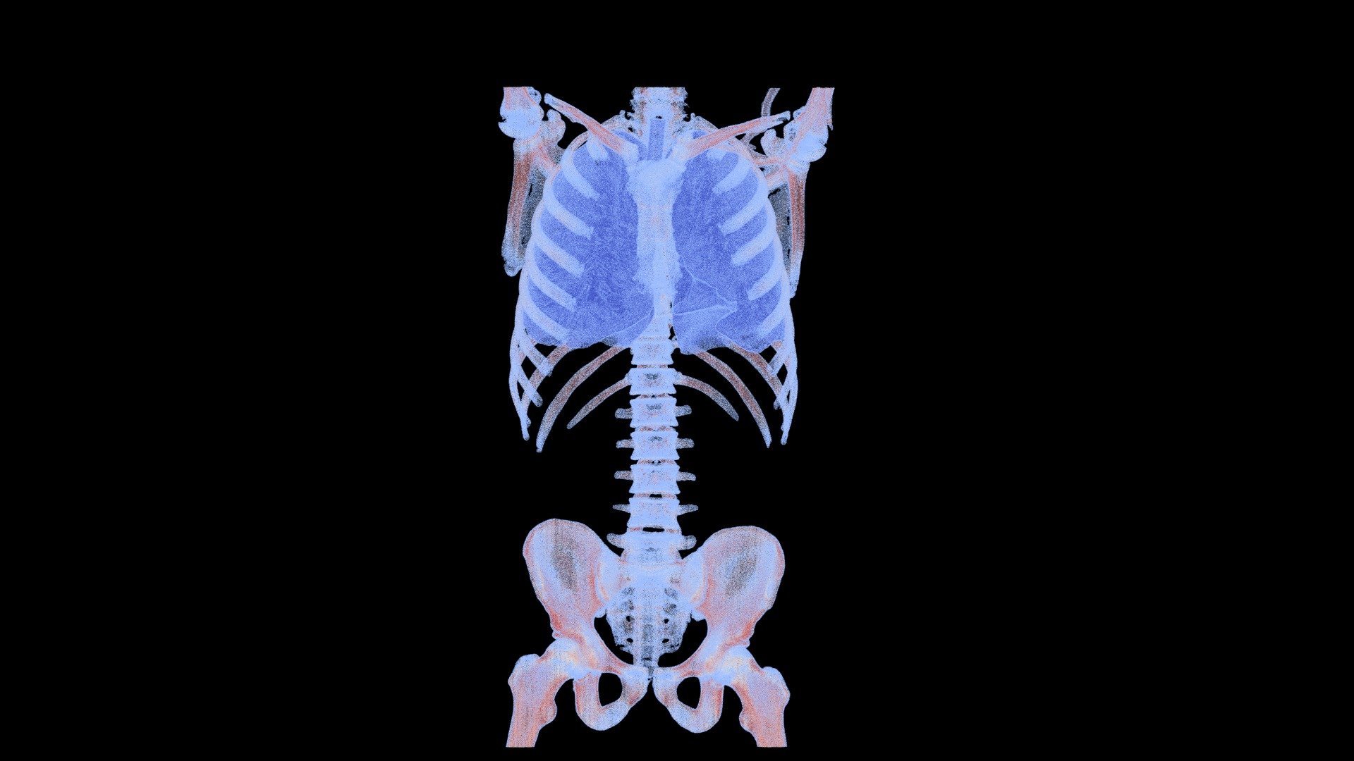 Bone and Lungs Point Cloud - 3D model by Terrie Simmons-Ehrhardt ...