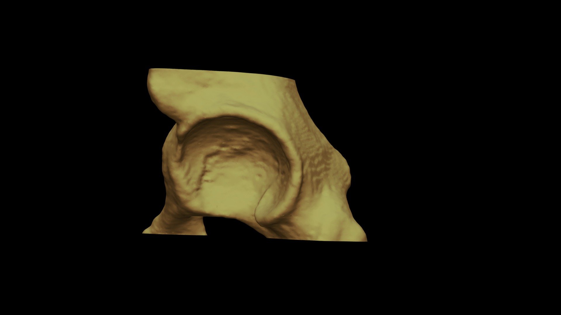 Cotyl (sans label) - 3D model by Prof. Serge VAN SINT JAN - Univ. Libre ...