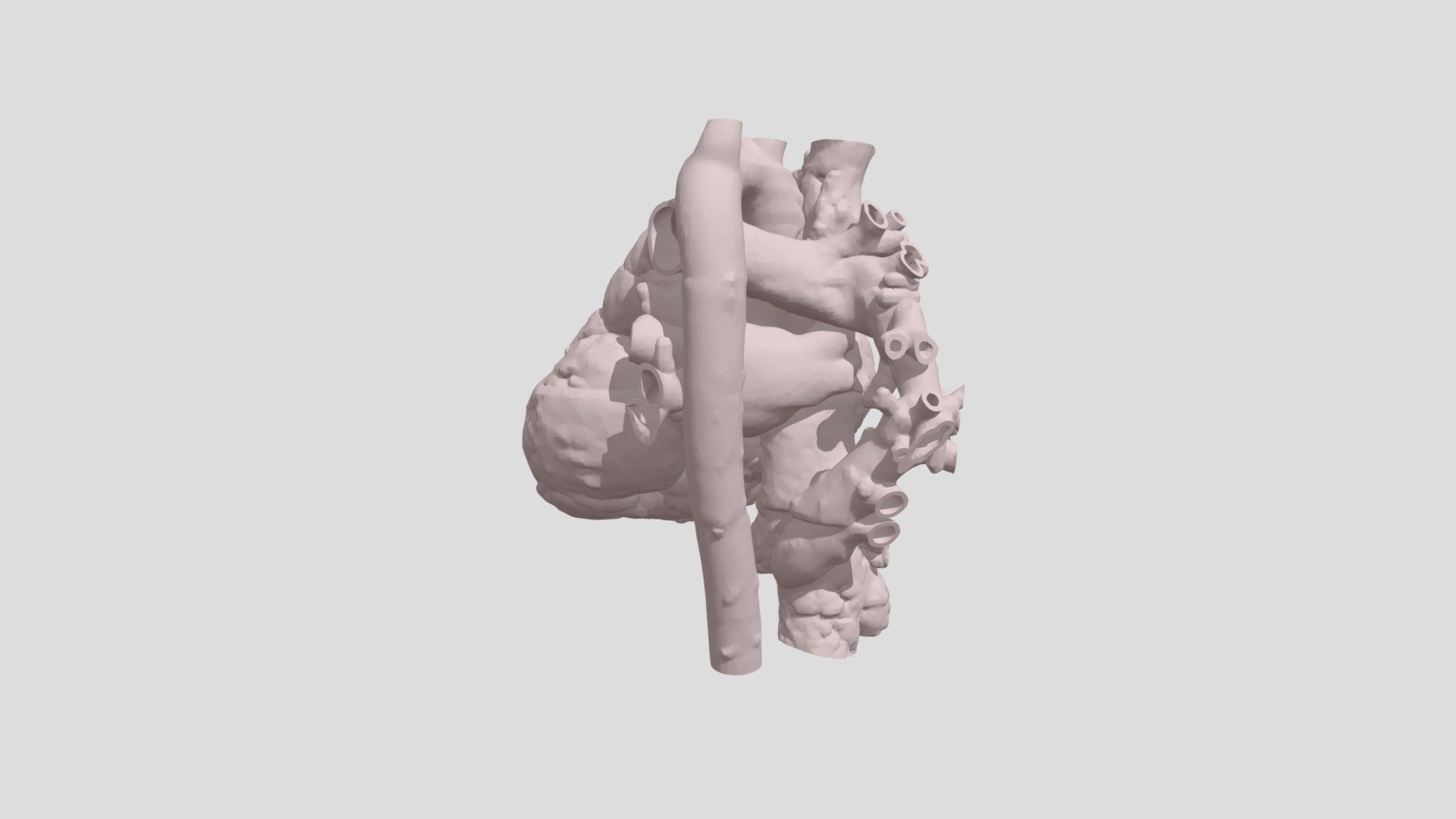 PAPVR (H0315) - 3D model by NCHS Cardiac Advanced Projects Lab 3D ...